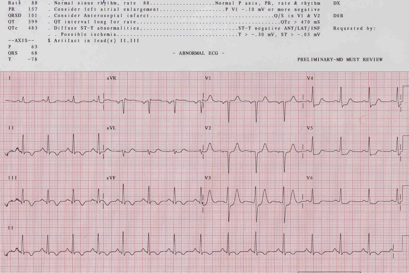NURSE ONLINE: USO DEL ELECTROCARDIOGRAMA VIRTUAL VS EL ...