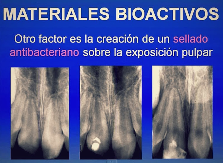 MATERIALES BIOACTIVOS en Odontología - Dr. Luis Karakowsky Kleiman