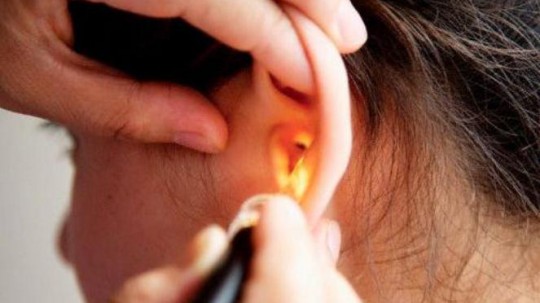 Cara Menyembuhkan Congek