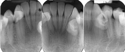 Dentistry lectures for MFDS/MJDF/NBDE/ORE: Dental Anomalies at ...