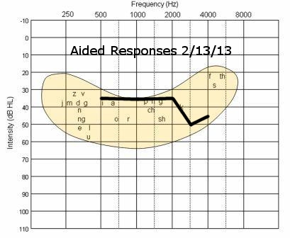 Say What?: Hearing Test and Audiogram