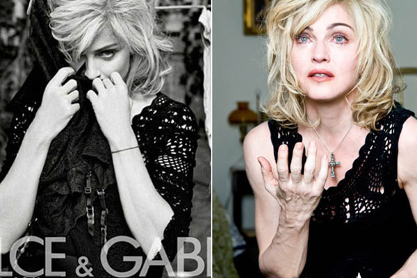 Skin Temple: HAND REJUVENATION- IMCAS review