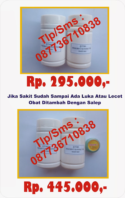 Jual Obat Sipilis | OBAT RAJA SINGA DE NATURE