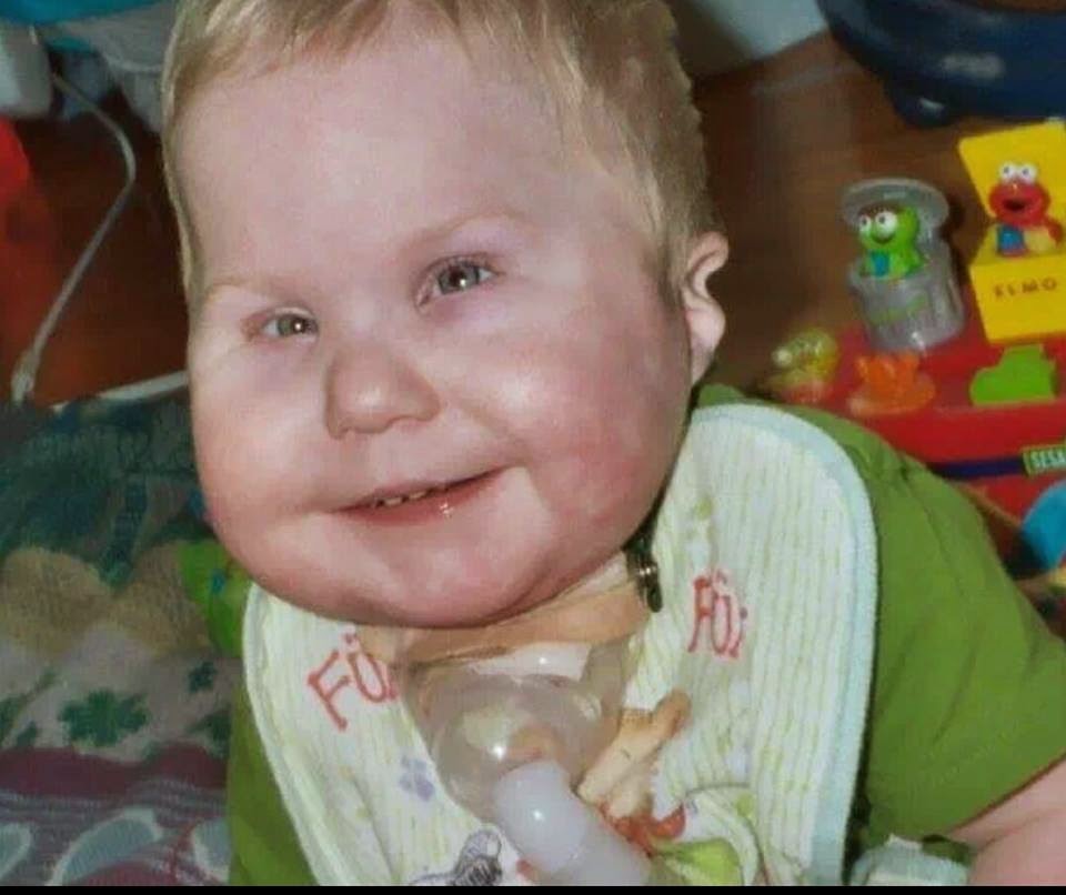 Faith Warrior: CHARGE Syndrome