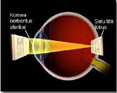 Mata Rabun Dan Silau : Carotomax Mampu Mengubahnya