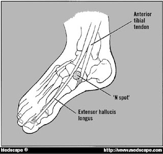 The Foot and Ankle Tribune: Navicular Fractures in Athletes