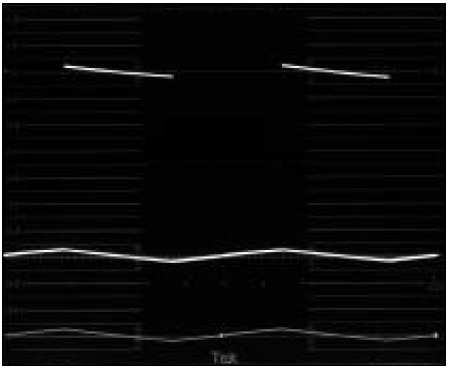 ANEKA INFO TEKNIK: PAL SYSTEM TELEVISION MEASUREMENT : FIELD TIME ...