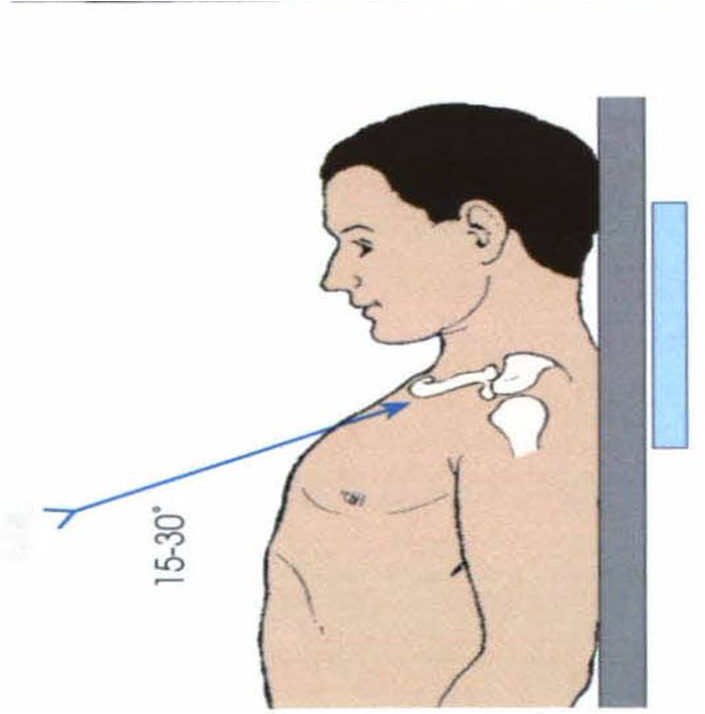TEKNIK RADIOGRAFI CLAVICULA - Radiografer