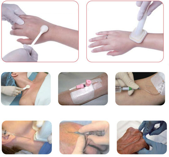 When Are Alcohol Swabs Used? - Sara Healthcare - Surgical, Medical ...