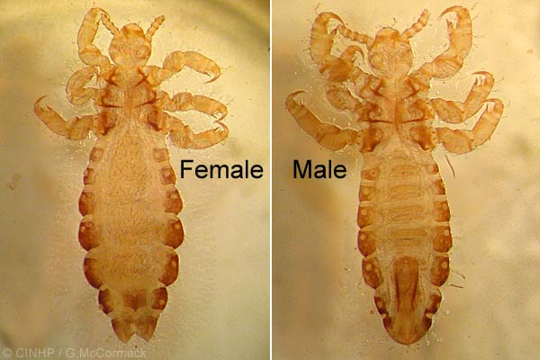 Pediculus Humanus capitis | [ HeaLthy Choise for yOUr Life ]