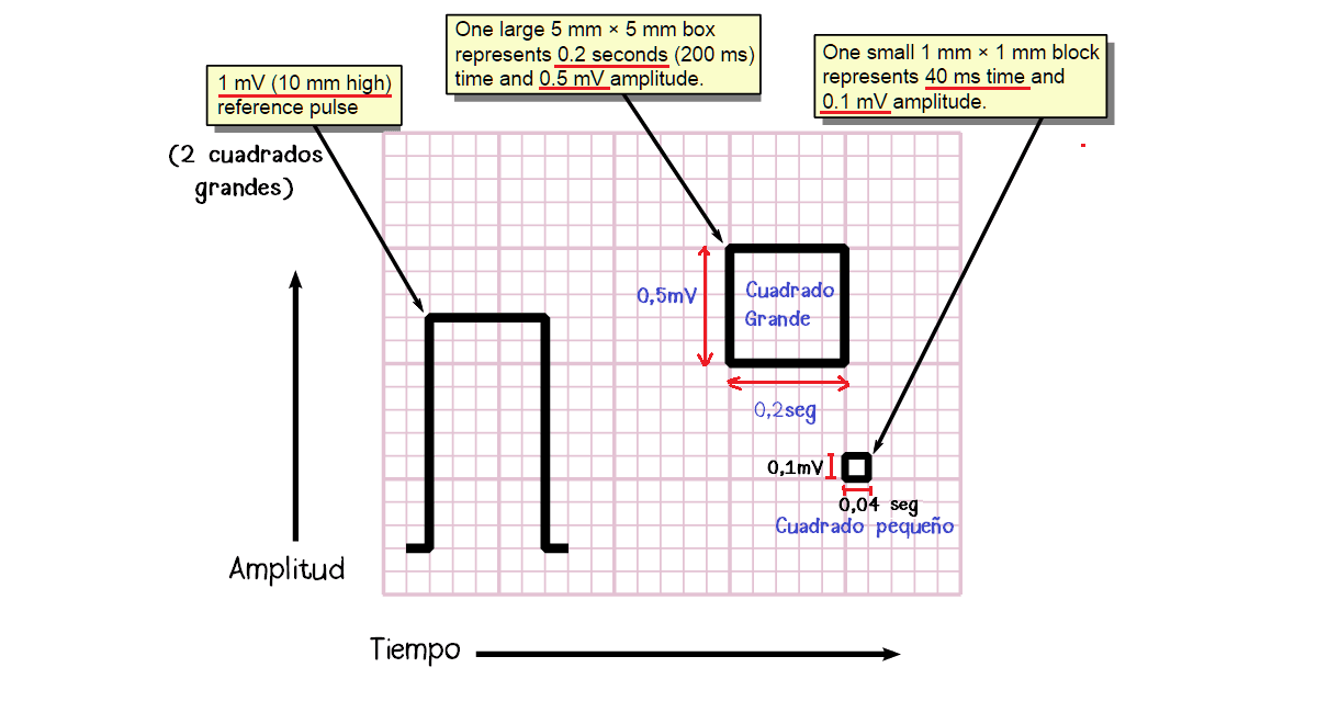 ECG normal (8): papel calibrado | Dr. Alberto Sanagustín