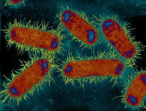 BACTERIOLOGIA: E. coli