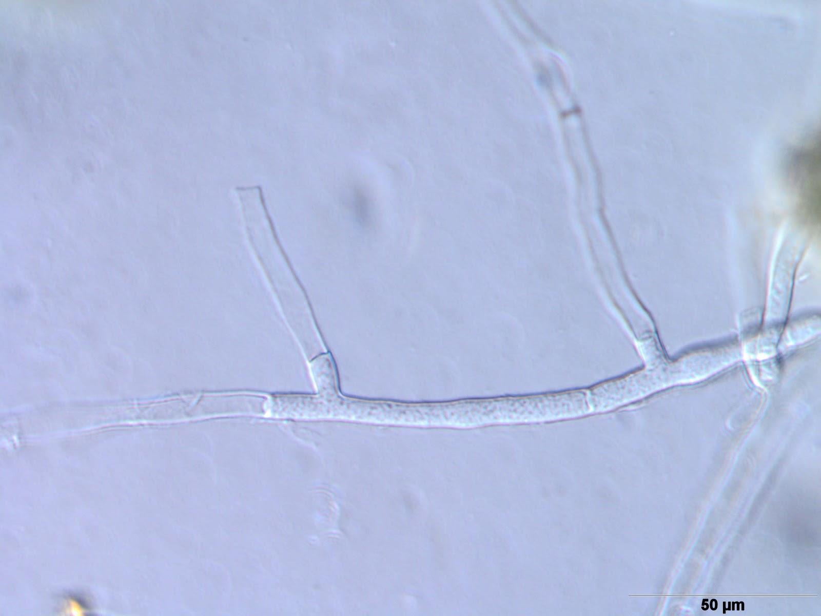 NCSU PDIC: Rhizoctonia Web Blight on Boston Fern