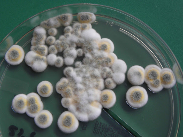 ATLAS MICOLOGIA: ASPERGILLUS VERSICOLOR