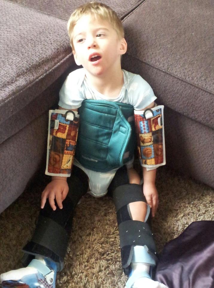 Types Of Leg Braces For Cerebral Palsy at James Hite blog