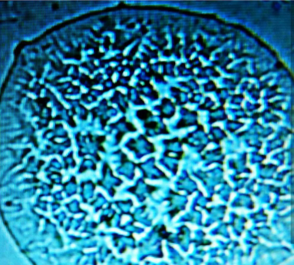 Michele's Microscopy: Pediastrum Duplex