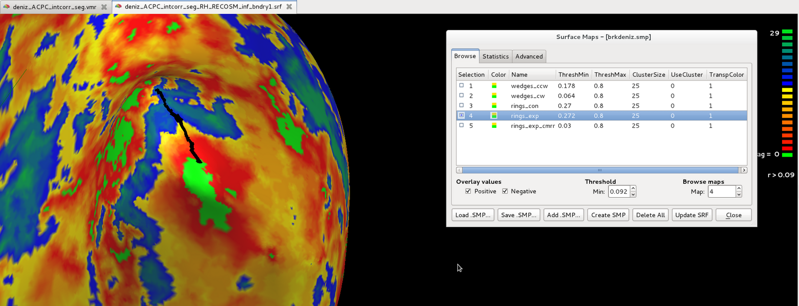 =Vision Group fMRI analysis guide=: Ring Stimulation with Single Shot ...