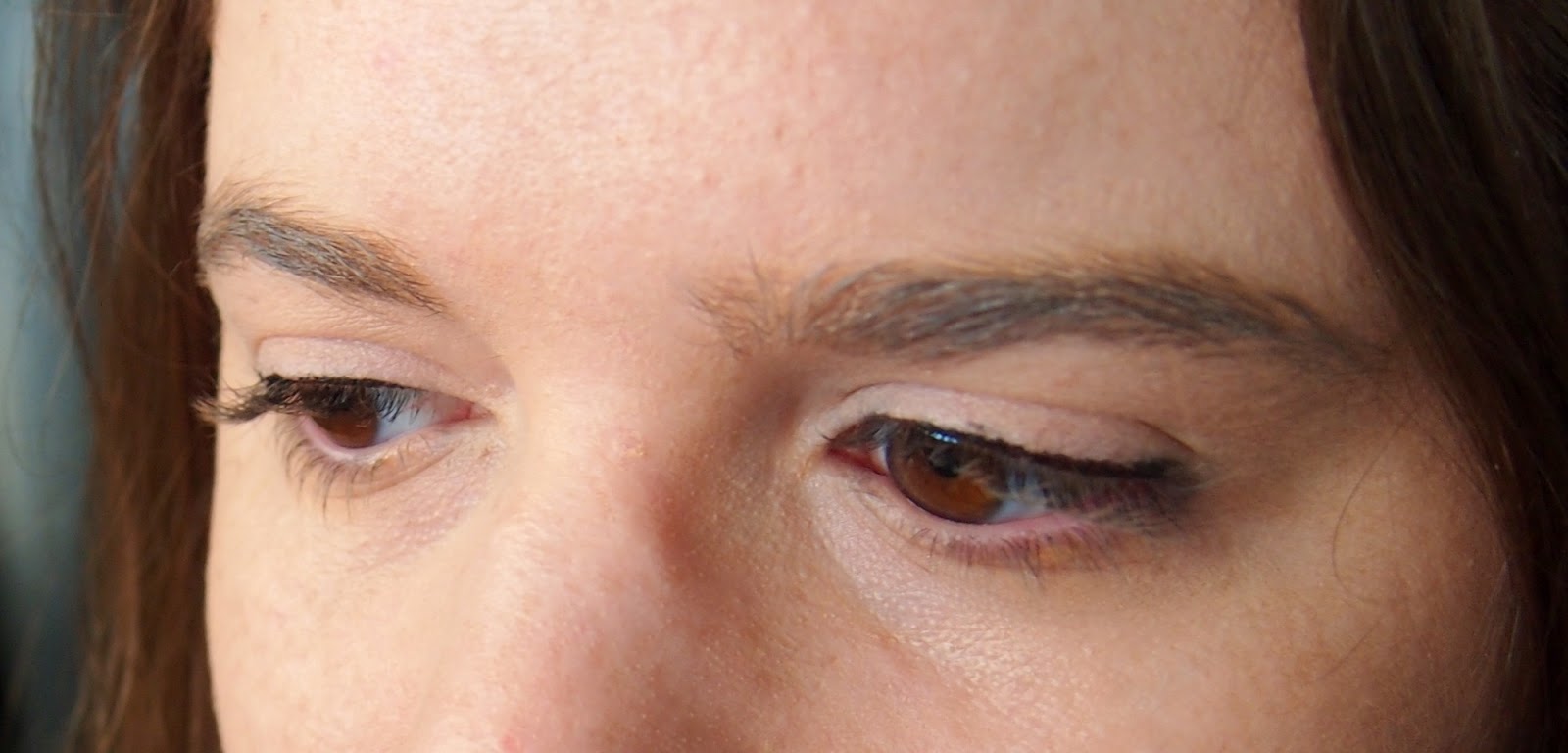 Removing Skin Tags from Eyelids - SweetieBomb