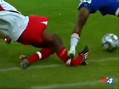 World’s Worst Football Sports injuries-Soccer injury ever