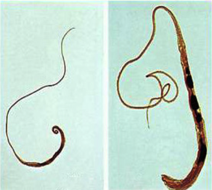 Trichuris trichiura