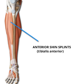 Primal Movement Solutions : ANTERIOR SHIN SPLINTS, COMMON CAUSES & HOW ...