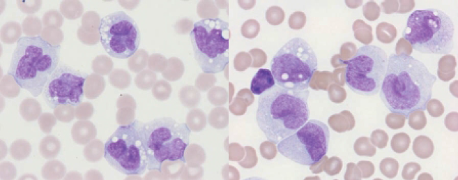 VETERINARY HEMATOLOGY DEXTERVET: Chronic myelomonocytic leukemia ...