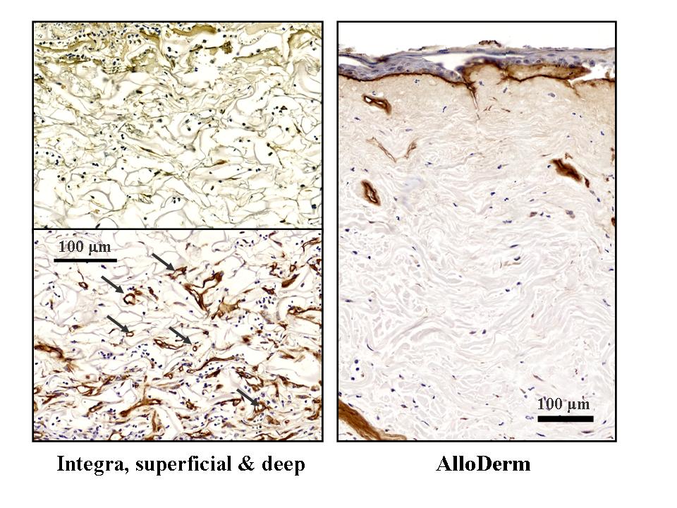 My unpublished biomedical research: Wound Healing and ...