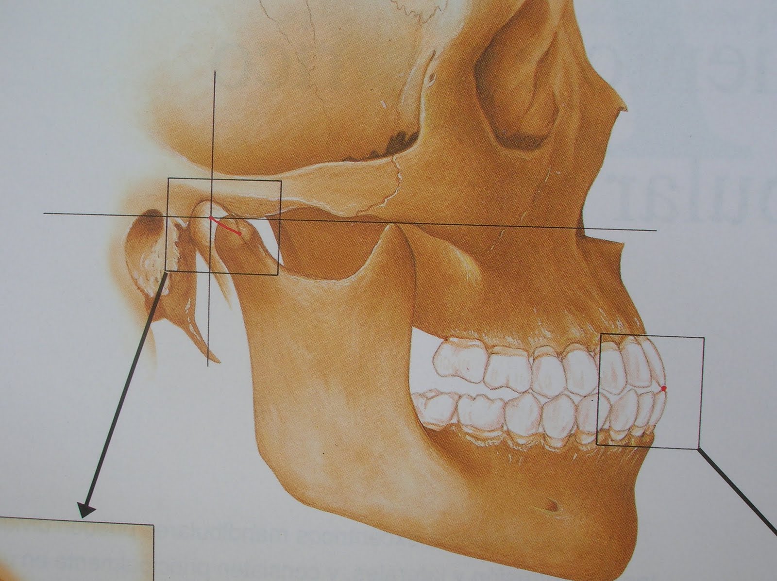 Articulação Temporo Mandibular e algumas das suas disfunções ...