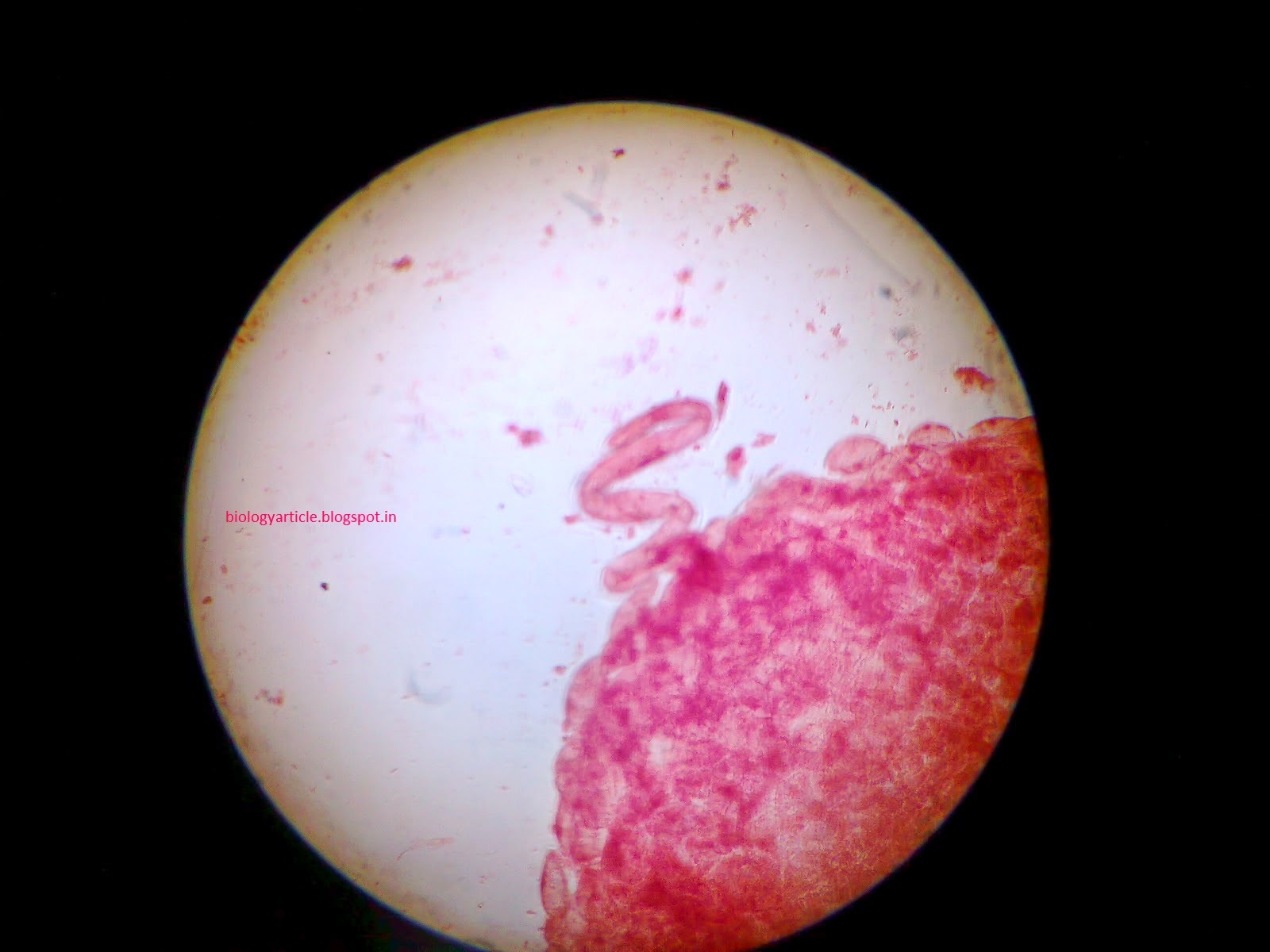 BIOLOGY WRITE-UP - BIOLOGY ARTICLES: HAUSTORIUM (haustoria): structure ...