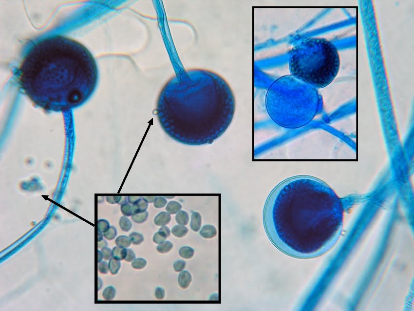Fun With Microbiology (What's Buggin' You?): Rhizopus species