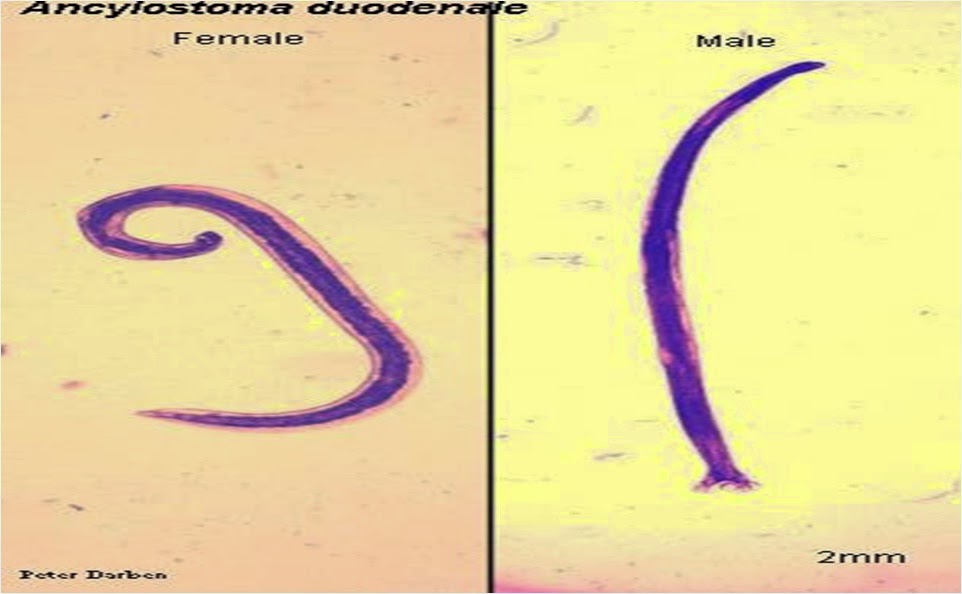 Uncinariasis O Anquilostomiasis Informacin Prctica