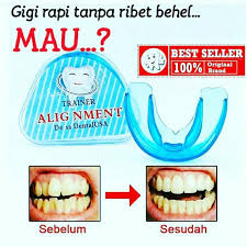 Perapih Gigi Teeth Trainer Alignment: Teeth Trainer Solusi Rapihkan ...