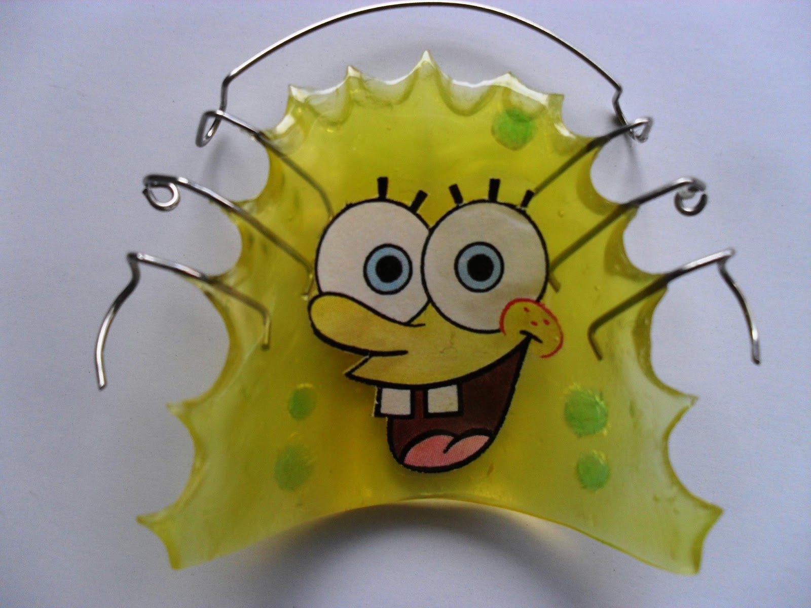 Fernando Carvalho Ortodontia : Aparelhos Personalizados