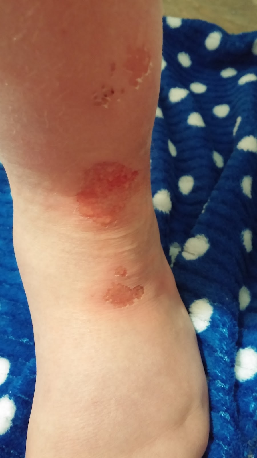 Treading the waters: Boys and their scrapes