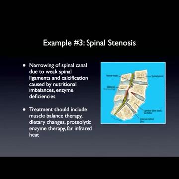 MAKLUMAT KESIHATAN DAN PENYAKIT: Sakit Saraf Sciatica 1 (urat di antara ...