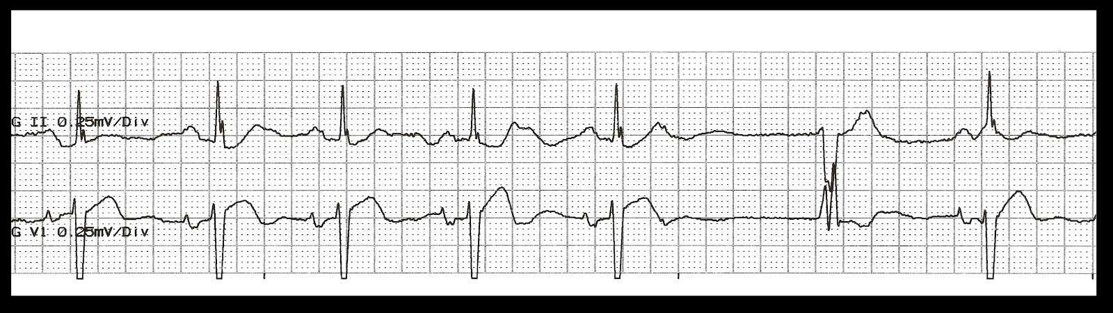 Various Escape Beats
