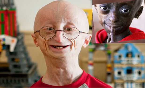 People with the Strangest Medical Conditions - NWeird