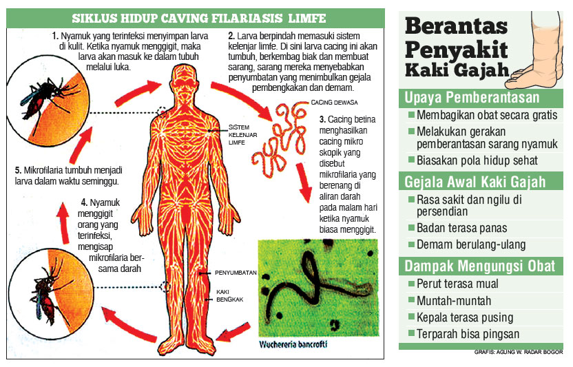Minum Obat Kaki Gajah Yuk!