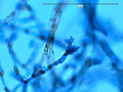 Fun With Microbiology (What's Buggin' You?): Fonsecaea pedrosoi/monophora
