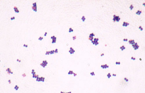 موقع الدكتور أحمد كلحى: صور بكتيريا - Slides of Bacteria : Aerobic Gram ...