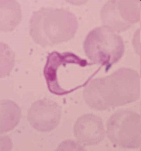 Ciencias de la Salud Humana: Estudio de Hemopárasitos