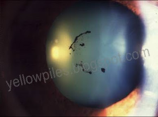Eye Pictures(OSPE) | MEDICAL CHOICES