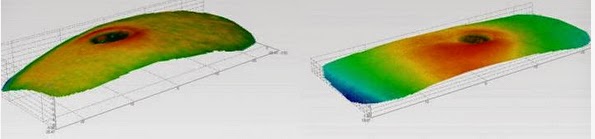 Electrical Stimulation speeds wound healing | NextBigFuture.com