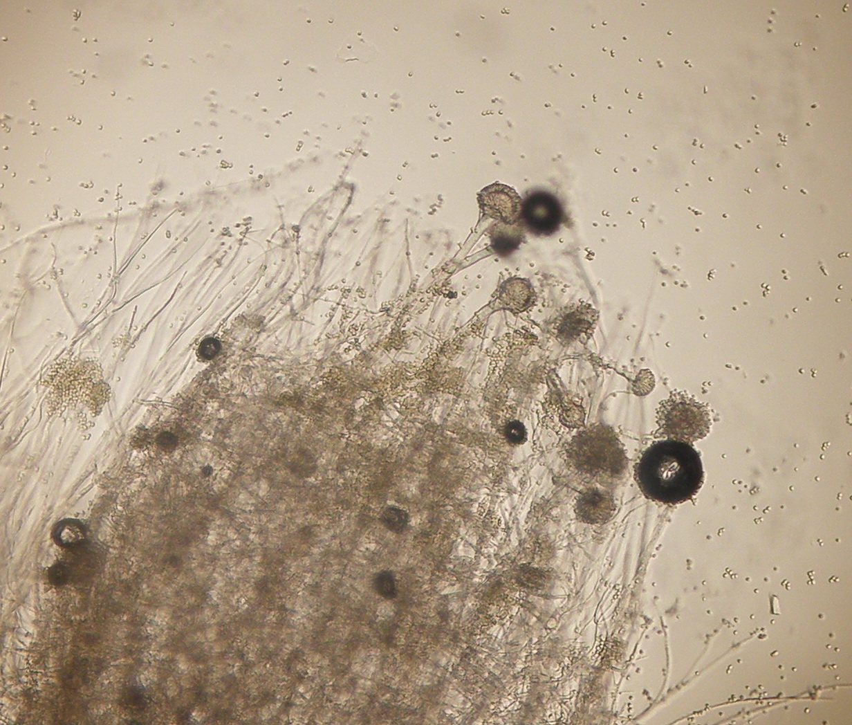 ATLAS MICOLOGIA: ASPERGILLUS FLAVUS