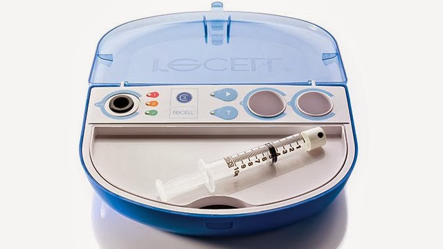 To Infinity And...In Theory: Spray-On Skin: New Severe Burn Treatment