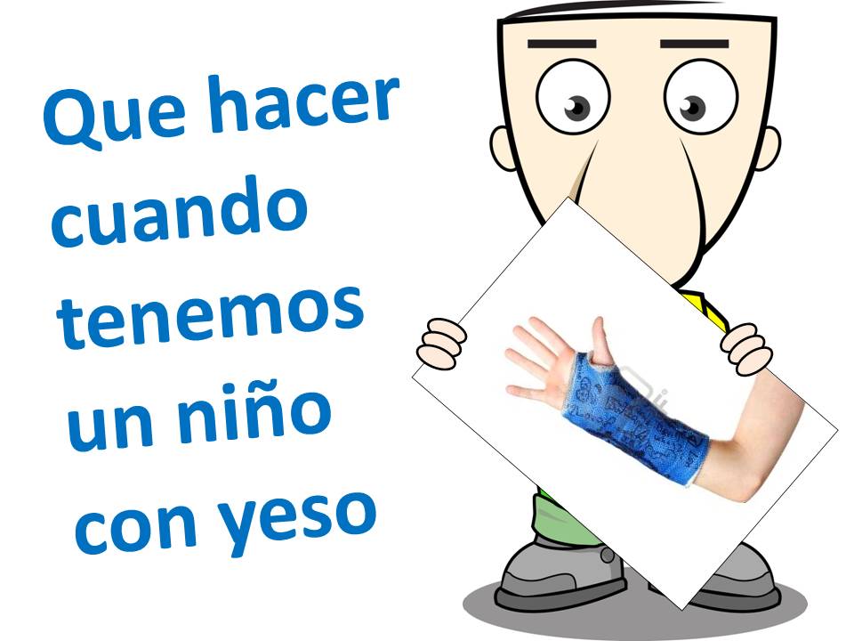 Mundo FiLi: Cuando tenemos un niño con yeso