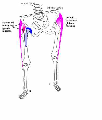 3D Rehab and Conditioning