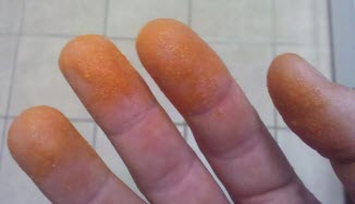 This is what is ruining America: 7. Cheeto Fingers