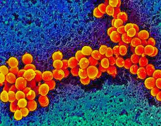 La magia de los OVNIS: Arqueobacterias