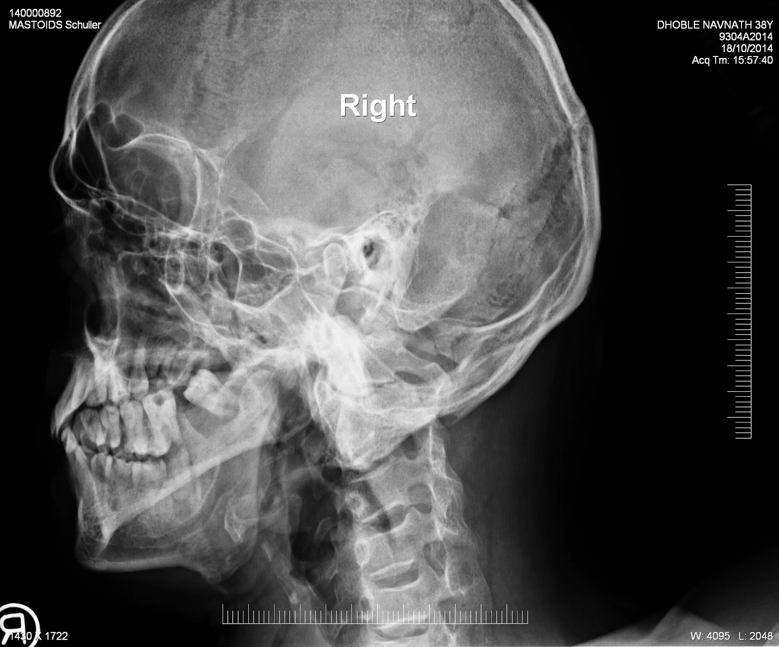 katie's blissful blog